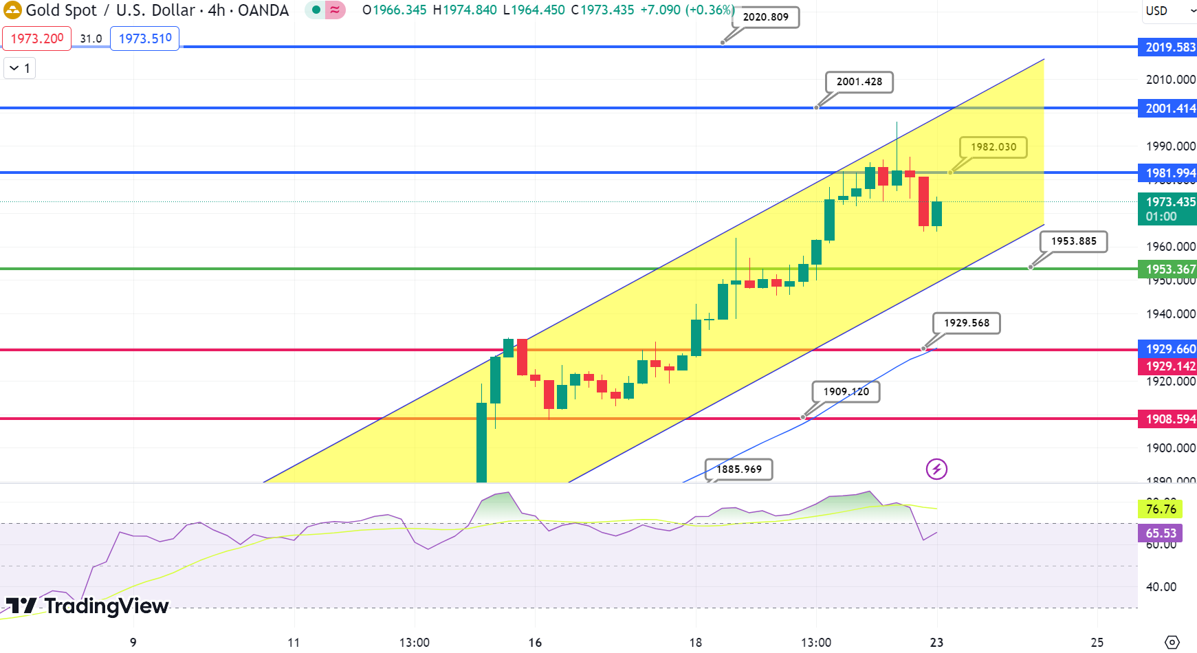 Gold Price Oscillation Amid Geopolitical Tensions and Economic Indicators - Forex News by FX Leaders